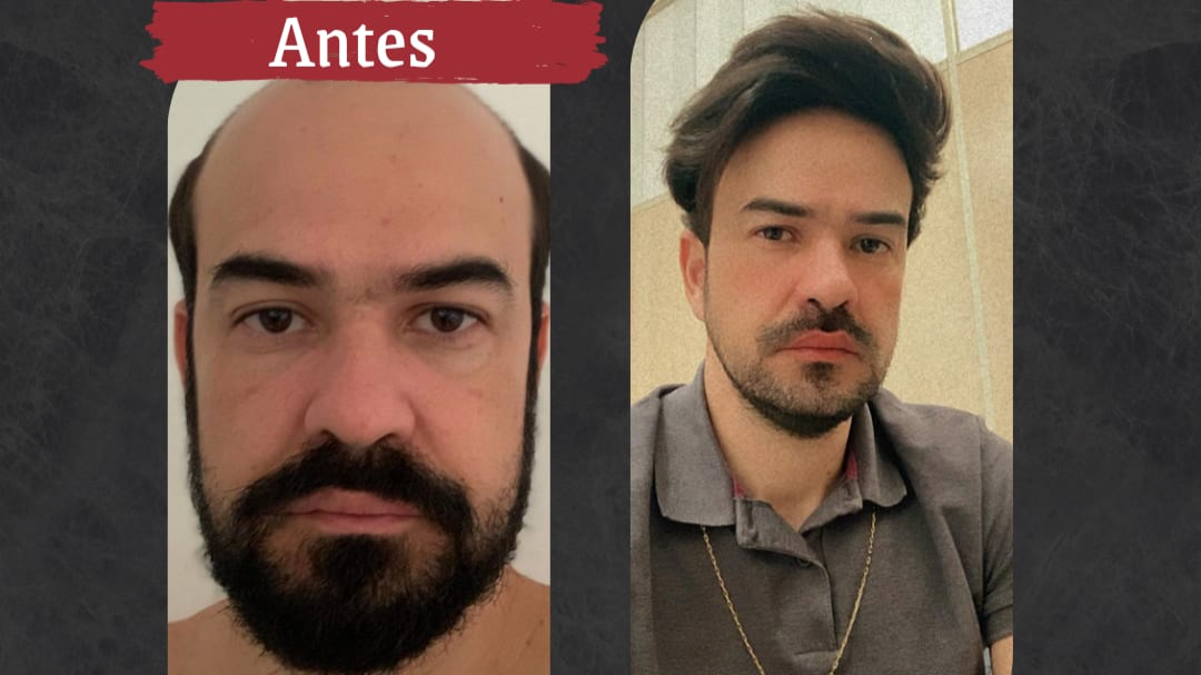 Danilo Lima — Bio Site